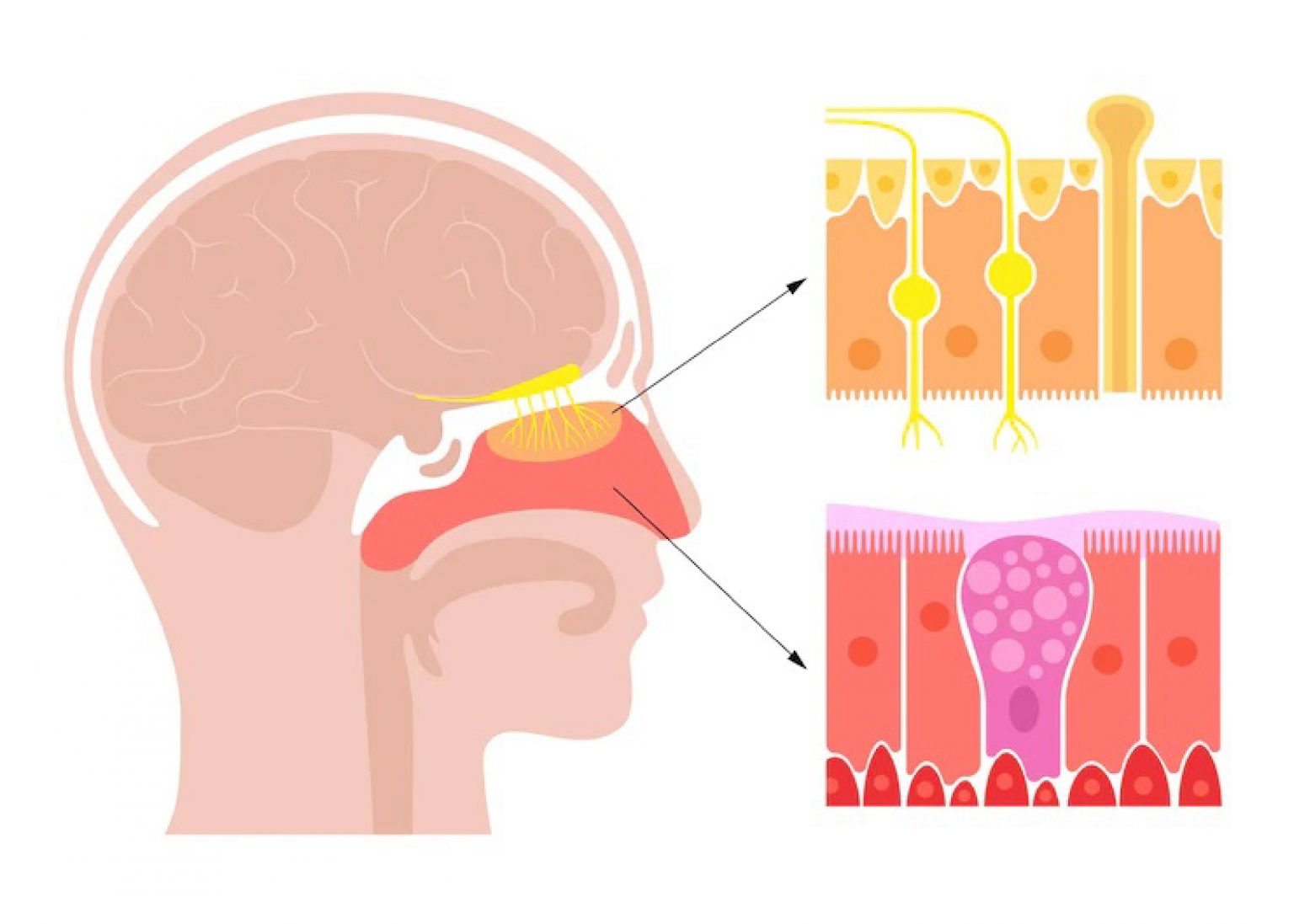 Rinitis Alérgica - Paramedic